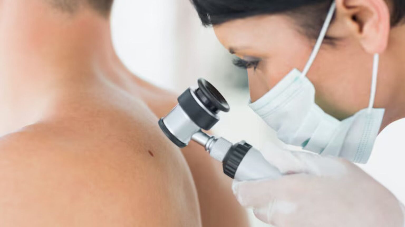 Which 5 criteria are used to detect melanoma?