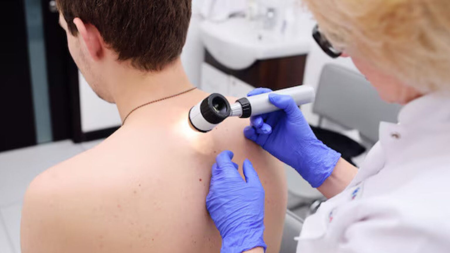 Full Body Mole Check: What to Expect and Why It’s Important